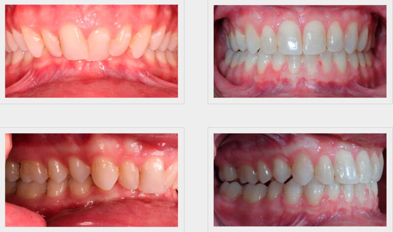 Truco para marcar la mandíbula rápido y de forma definitiva – Rísbel ...